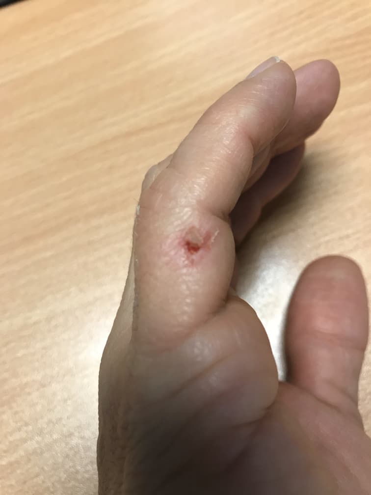 Another Country, Another Very Serious Wound – Den's Blog